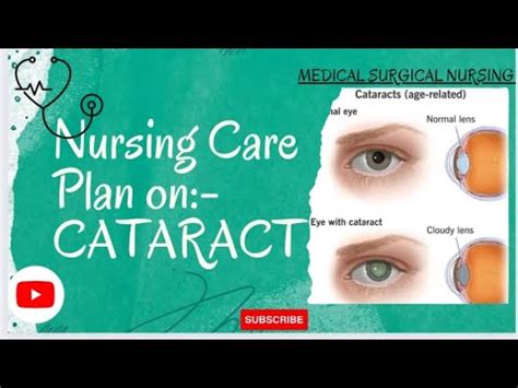 Nursing Care Plan On CATARACT NCP IN HINDI CATARACT MSN YouTube