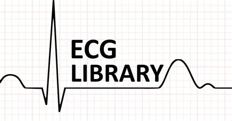Hypertrophic Cardiomyopathy HCM LITFL ECG Library Diagnosis