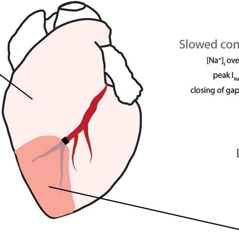 Cardiac Action Potential In Normal And Ischemic Myocardium Left