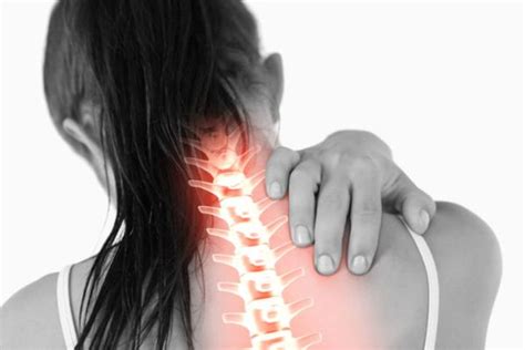 La N Vralgie Cervico Brachiale Ou Sciatique Du Bras