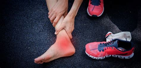 Ankle Sprain Vs Fracture Understanding The Differences