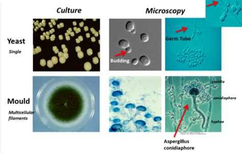 Medical Microbiology 4 Yeast Mould Flashcards Quizlet