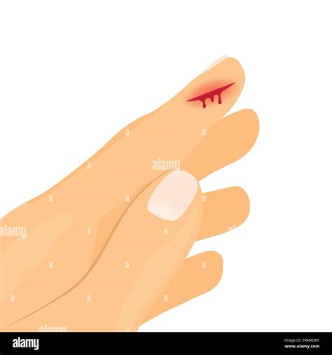 Bleeding Blood From The Finger Wound Vector Illustration Stock Vector