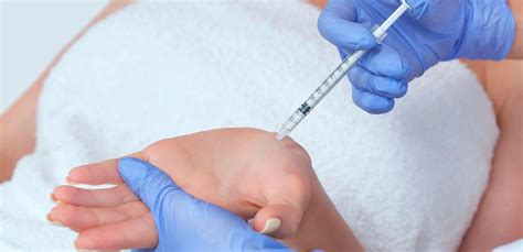 Hiperhidrosis en las manos Exceso de sudoración en manos en Bogotá