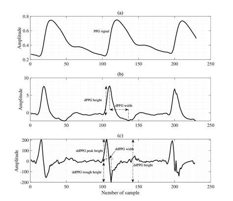Feature Extraction From The St And Nd Derivative Of Ppg Waveforms