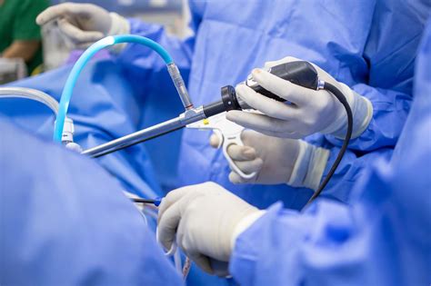 Vantagens Da Cirurgia Minimamente Invasiva Dr Fabio Fin