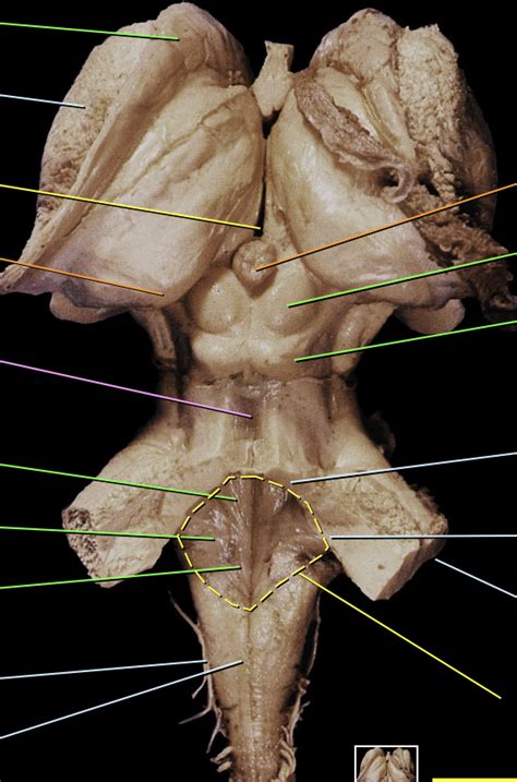 Brainstem Dorsal View Diagram Quizlet