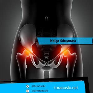 Kalça Sıkışması impingement Hastalığı Prof Dr Turan Uslu 2023