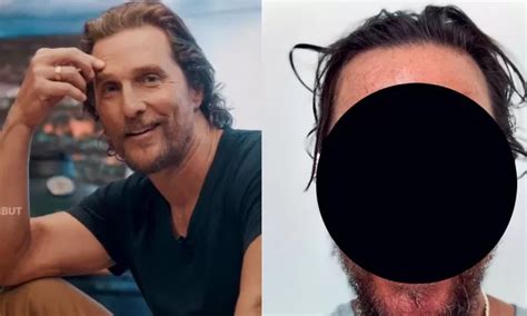 El actor tuvo una reacción alérgica y se viralizó
