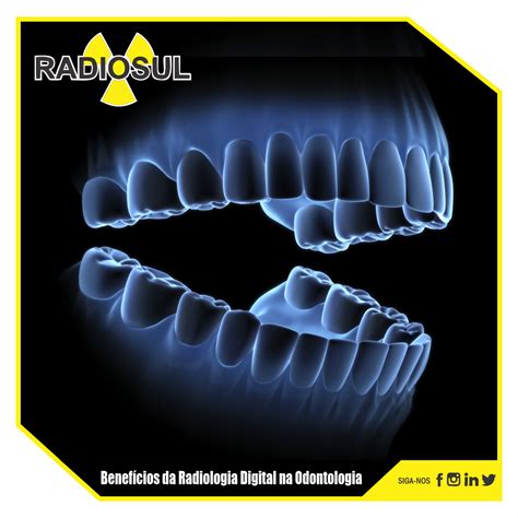 RadioSul Digital Benefícios da Radiologia Digital na Odontologia