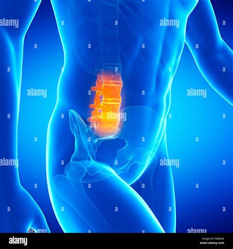 Albums 99 Pictures Pictures Of The Lumbar Spine Stunning