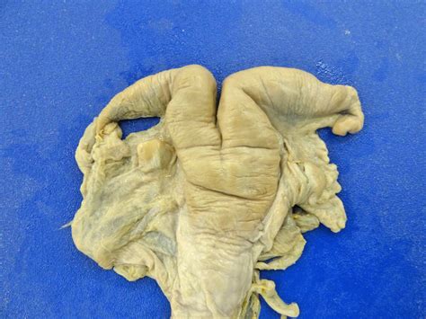 Sistema Reprodutor Ruminante Anatomia Veterin Ria I