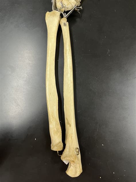 Anatomy Appendicular Skeleton Radius And Ulna Anterior View Diagram