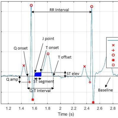 a electrocardiogram ecg signal after denoising baseline wander download scientific diagram