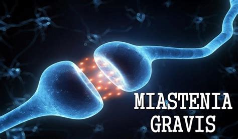 Miastenia Gravis causas síntomas y tratamiento AGENCIAFE
