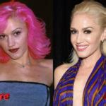 Gwen Stefani Plastic Surgery Then And Now