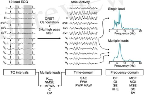 overview of electrocardiogram ecg signal processing and complexity download scientific