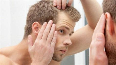Croste In Testa Negli Adulti Cause Principali E Rimedi Naturali