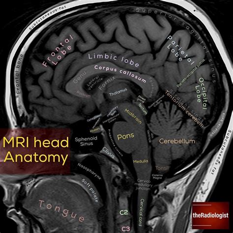Sagittal View Of Brain Mri