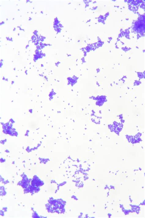 Streptococcus Pneumoniae Bacteria Lm Photograph By Science Stock