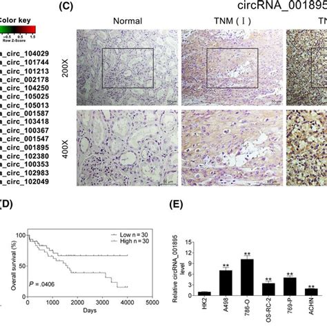 Circular Rna Circrna Hsa Circ Was Upregulated In Both Clear