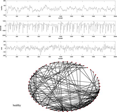 epileptic seizure detection in eegs signals based on the weighted visibility graph entropy