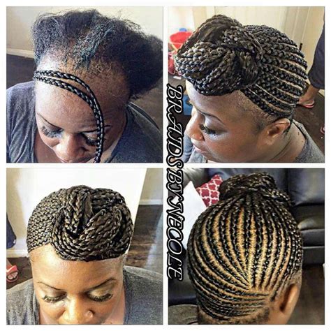 Thin No Edges Hairstyles 14 Extraordinary Alopecia Camouflage