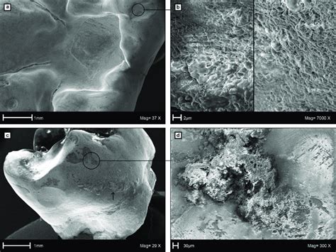 Scanning Electron Microscopy SEM Images Of The Caries Cavity And