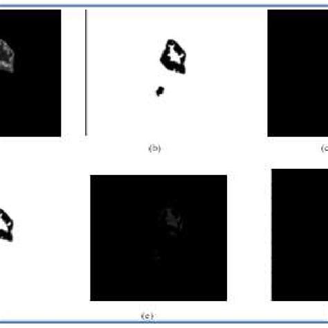 the comparison of segmented image using et al d otsu segmentation download scientific
