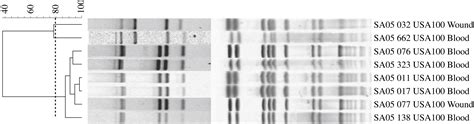 corrigendum to “multiple locus variable tandem repeats analysis of meticillin resistant