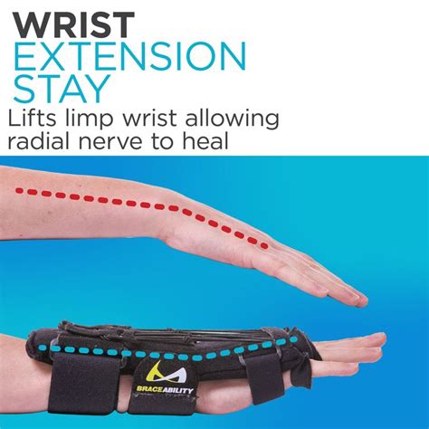 An Ad For Wrist Extension Stay With The Text Lifts Limb Wrist Allowing