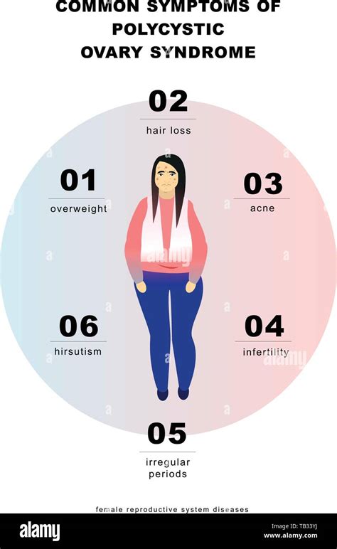 PCOS Symptoms Infographic Vector Illustration Stock Vector Image Art