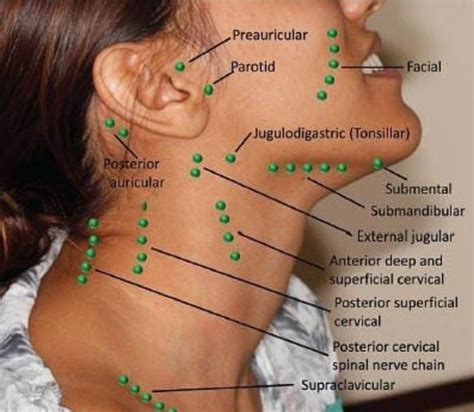 Lymph Nodes Distribution MEDizzy