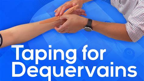 Dequervains Tenosynovitis Taping Technique Youtube