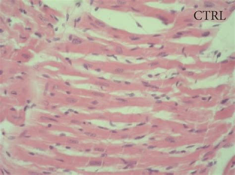 Representative Photomicrographs Of H E Staining Of LV Tissue Ad A