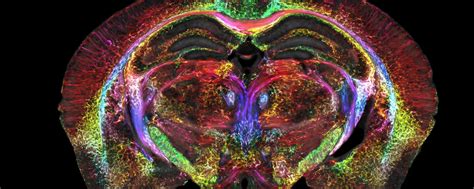Brain MRIs Just Got A Thousand Times Sharper