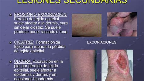 PATOLOGÍAS FRECUENTES DE LA PIEL YouTube