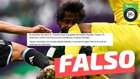 Imagen El Escaneo De Rayos X Muestra Que El Jugador De Arabia