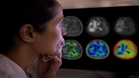 Philips y Synthetic MRI introducen una avanzada tecnología de imágenes