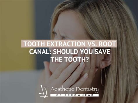 Tooth Extraction Vs Root Canal Should You Save The Tooth