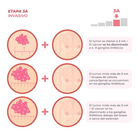 Estadíos del Cáncer de Mama Festival de la Mujer