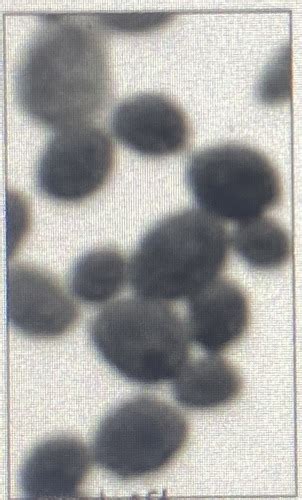 Different Types Of Yeast Role Of Fungi In Natural And Industry Fungal