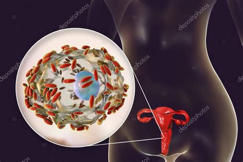 Vaginosi Batterica Secrezioni Vaginali Contengono Cellule Epiteliali