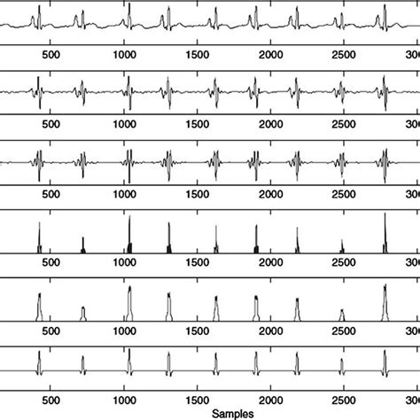 qrs detection algorithm processing steps a output of bandpass filter download scientific