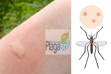 5 picaduras más comunes de insectos