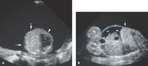 Thorax Radiology Key