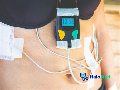 Elektrokardiogram Ekg Holter Jak Przebiega Badanie Jak Si