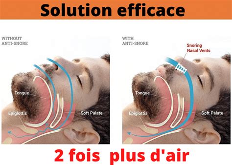 Ce que lon ressent quand on a le nez bouché Blog actu Communique de