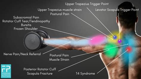 Shoulder Pain Diagnosis Chart Shoulder Pain Location Chart