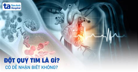 Cơn đau thắt ngực ổn định Nguyên nhân triệu chứng và điều trị